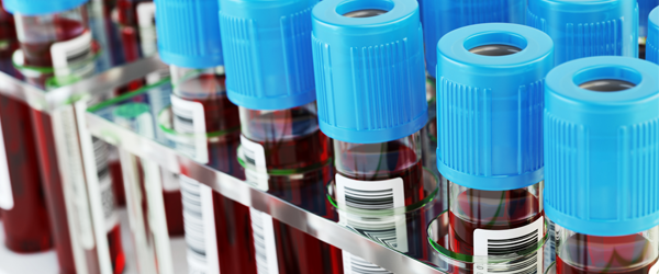 The Dos and Don'ts of Labeling Specimens For Pathology - Labtag Blog