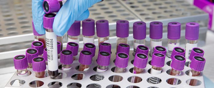 9 Ways to Improve Turnaround Time in Medical Laboratories - Labtag Blog