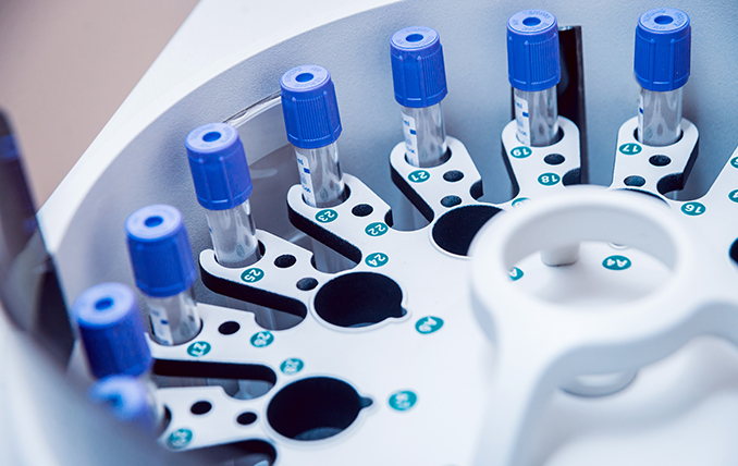 The History & Rise of Cancer Diagnostics - Labtag Blog