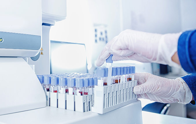 Biospecimen Labeling & How it Will Help Your Lab Effectively Track Data ...