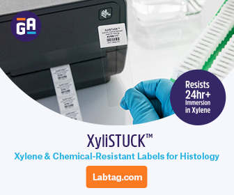 Breakthrough: GA International Announces the Launch of XyliSTUCK® - Labtag Blog