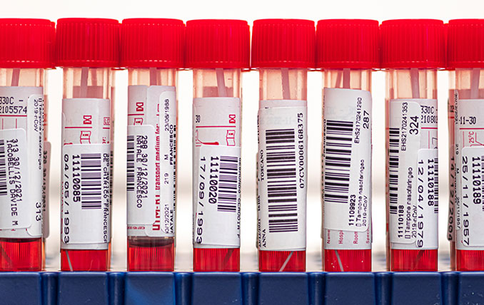 How to Avoid Errors in the Diagnostic Lab - Labtag Blog