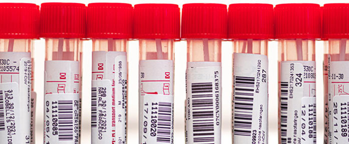 How to Avoid Errors in the Diagnostic Lab - Labtag Blog