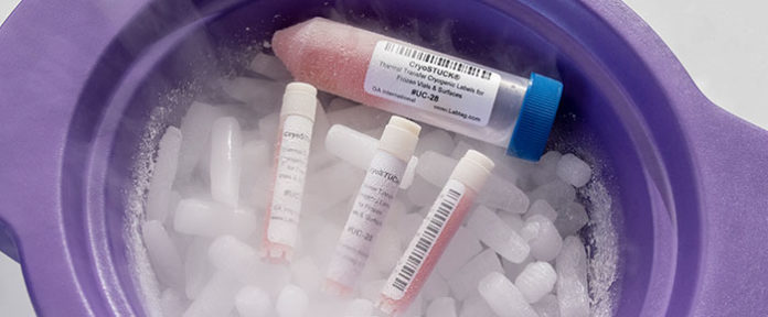 How Long Can You Store Samples in the Freezer? - Labtag Blog