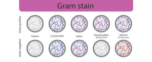 Labeling Gram Stains in the Lab - Labtag Blog