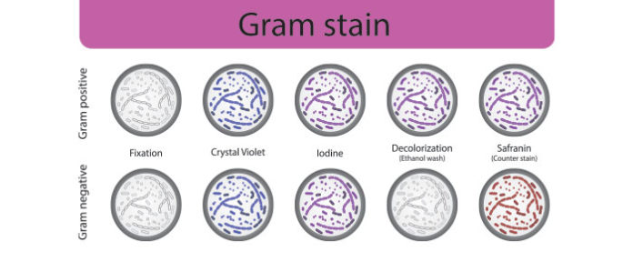 Labeling Gram Stains in the Lab - Labtag Blog