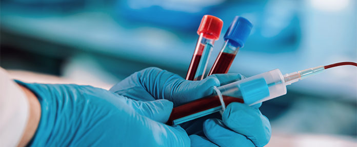 Tips for Avoiding Errors During Phlebotomy Specimen Collection - Labtag ...